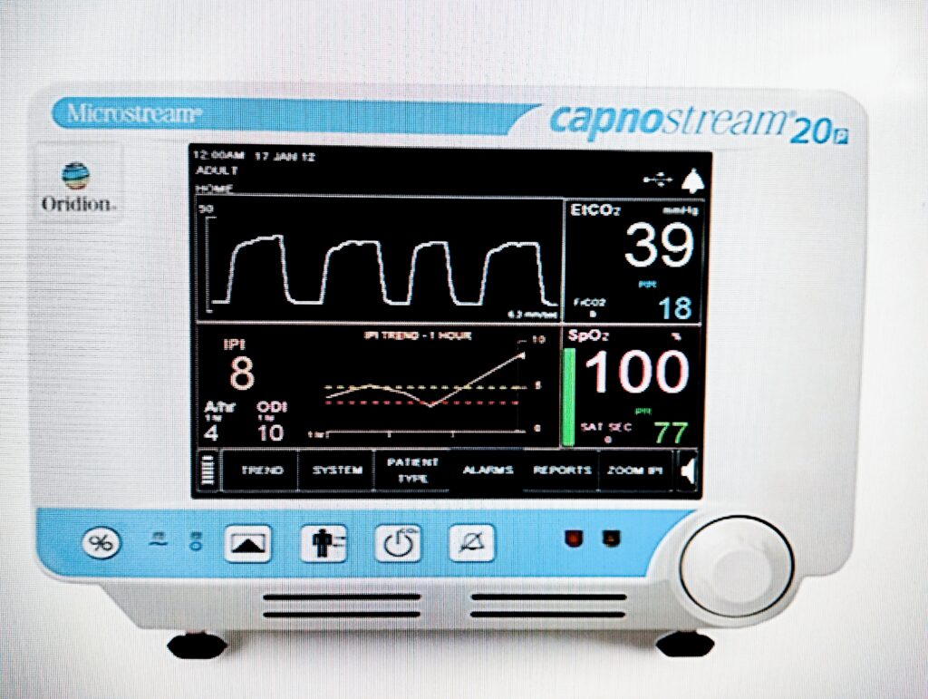 How valuable is the Capnostream 20p besdside monitor?
